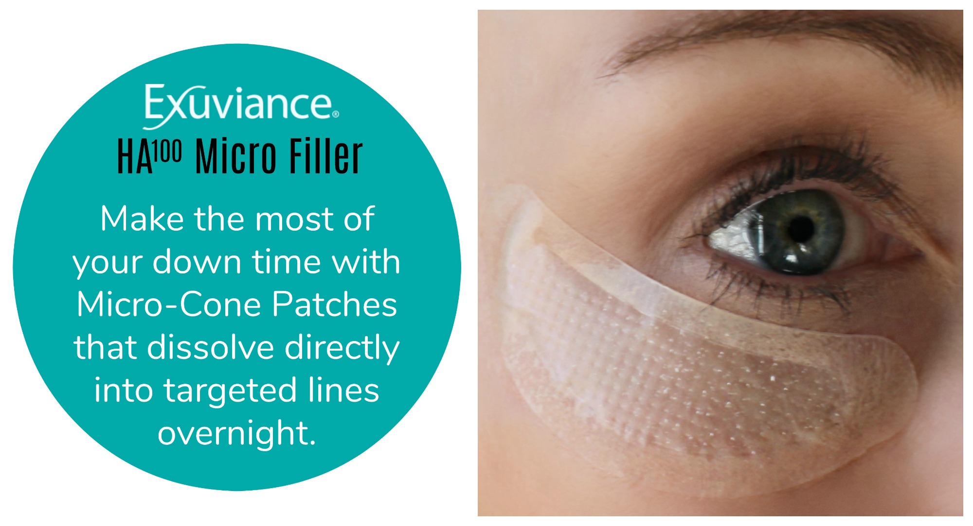 Exuviance HA100 Micro-Filler Skin Treatment for Deep Lines - Jenny at ...